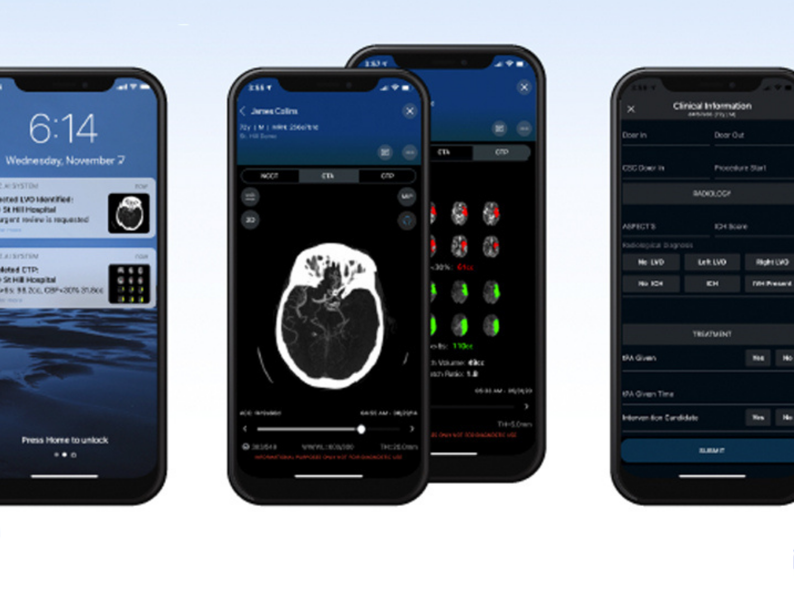 Viz.ai: The System of Action for Diagnostic Decision Making - Scale ...